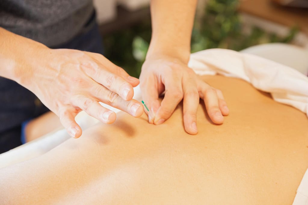 Acupuncture Costs, Modalities, and Treatment Approaches